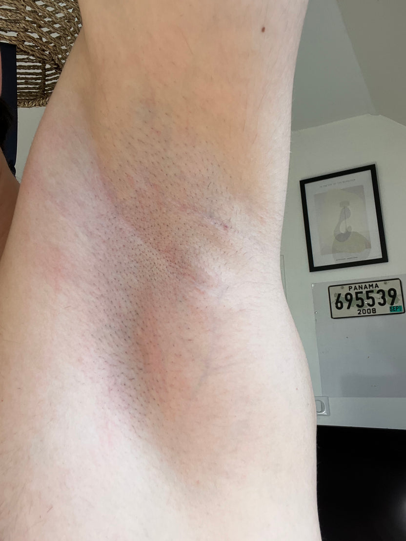 Professional At-Home Waxing Kits for Smooth Skin, Easy & Effective ...